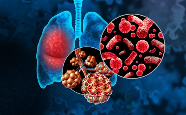 Human trials launch for new pneumococcal disease vaccine | iiCON